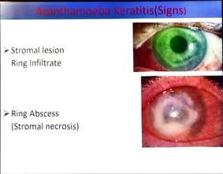 Cornea 3 RB sir .pdf