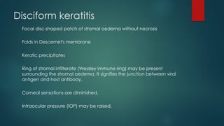 cornea 3 Viral keratitis fourth year MBBS eye lecture | PPTX