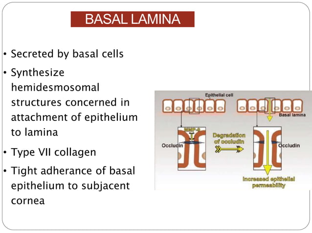 Minimalinvasiveglaucomasurgerylllll.pptx