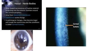 Cornea anatomy & physiology | PPTX