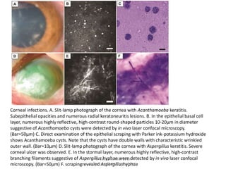 Cornea and ocular surface anatomy and physiology | PPTX