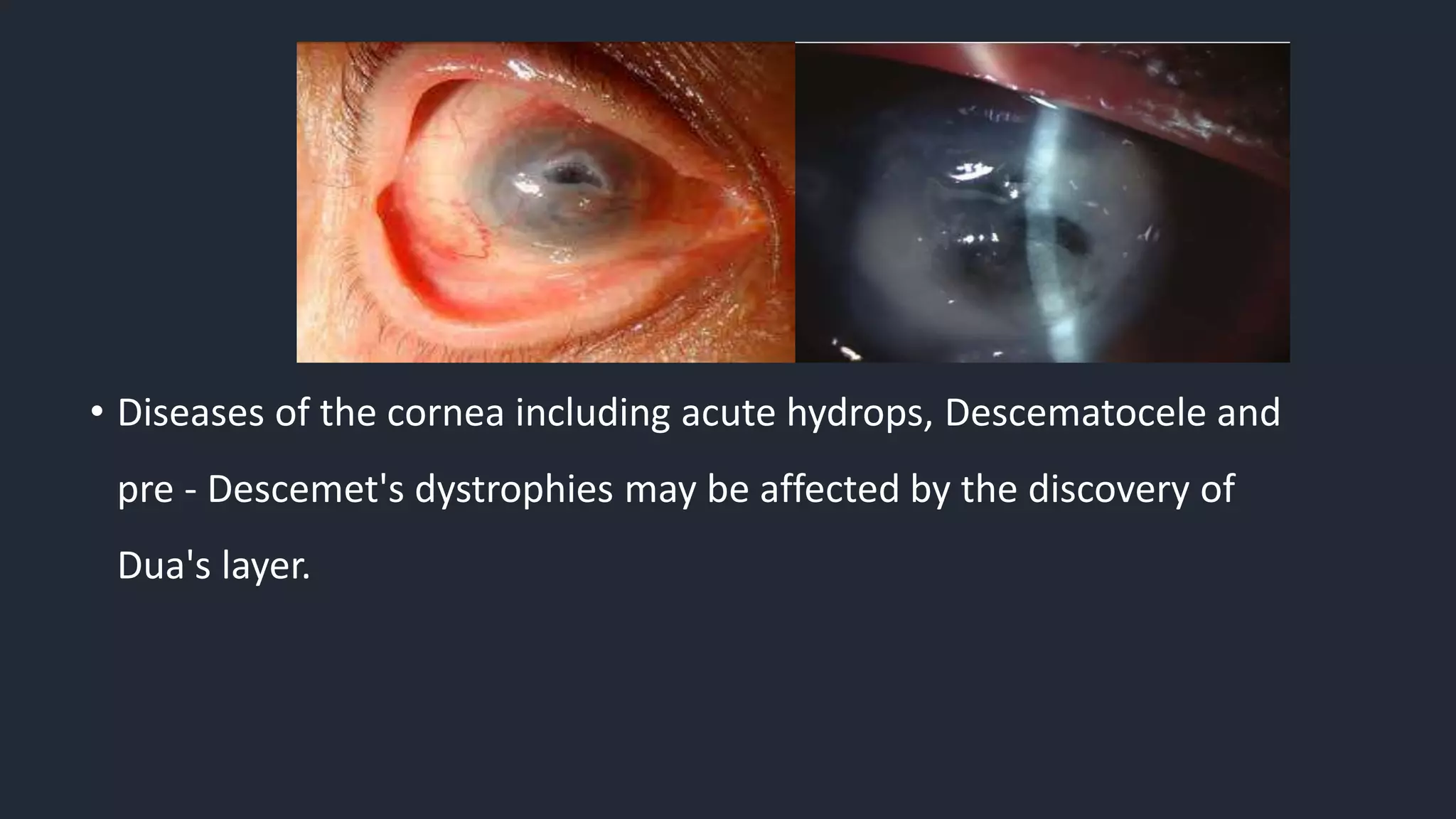 Cornea Applied anatomy.pptx