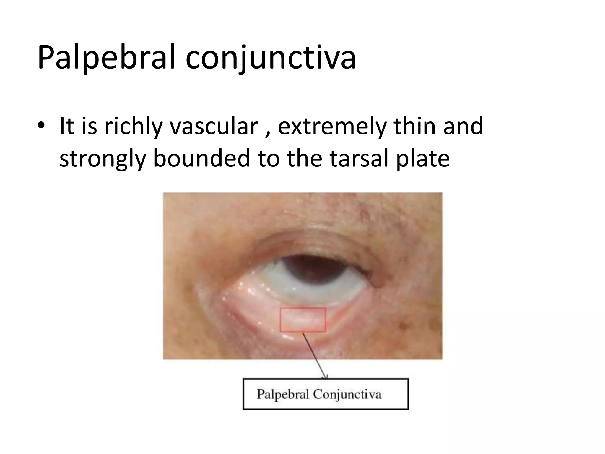 Anatomy of lacrimal apparatus and conjunctiva | PPTX