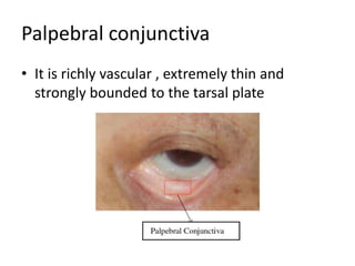 Anatomy of lacrimal apparatus and conjunctiva | PPTX
