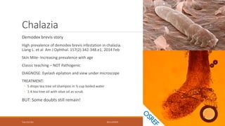 Focus on the three C's - Cornea, chalazion & Cross Linking | PPTX