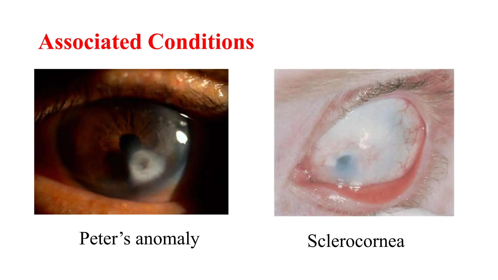 Corneal anatomy and anatomy of limbus ! | PPTX