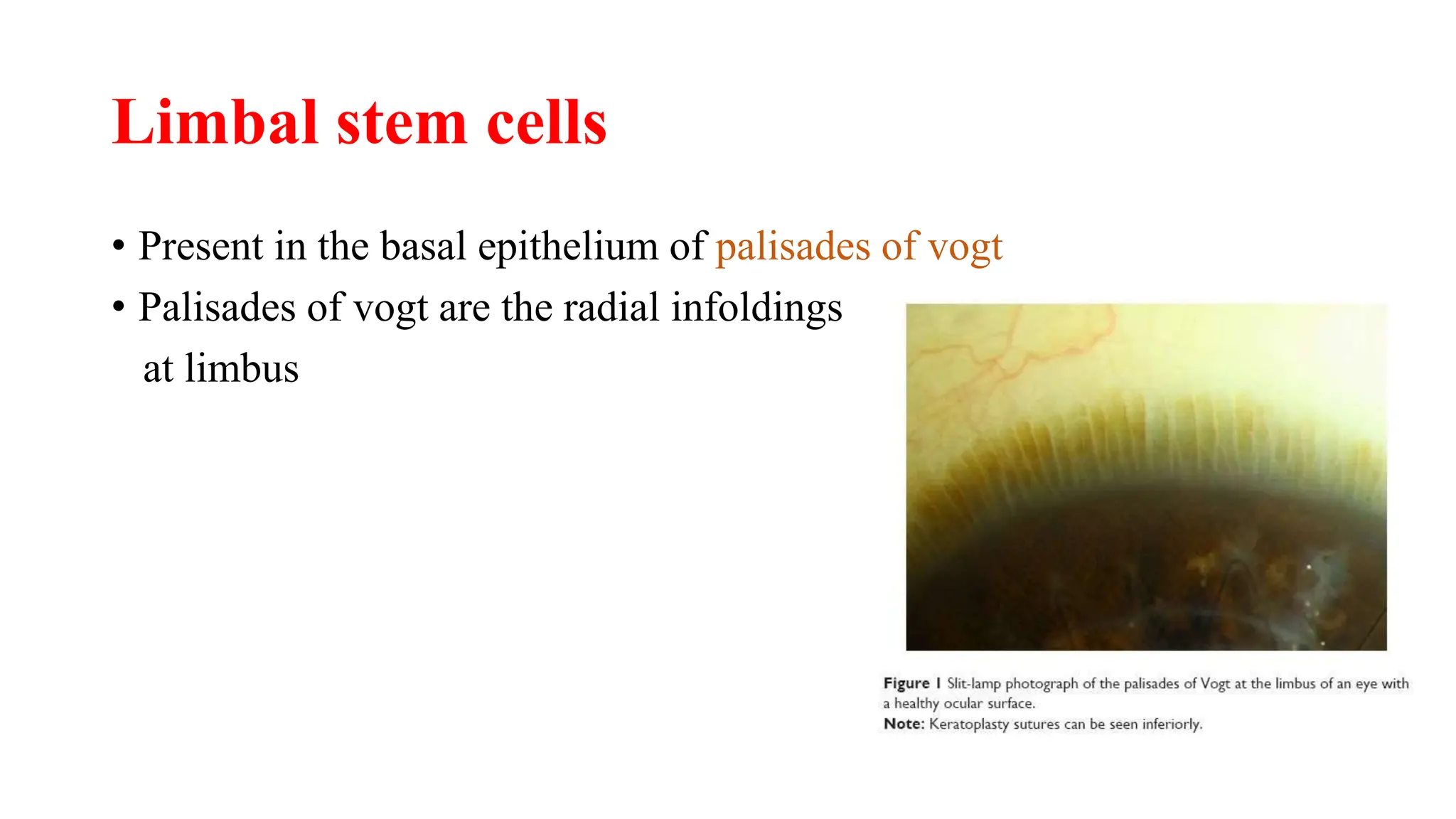 Corneal anatomy and anatomy of limbus ! | PPTX | Eye and Vision ...