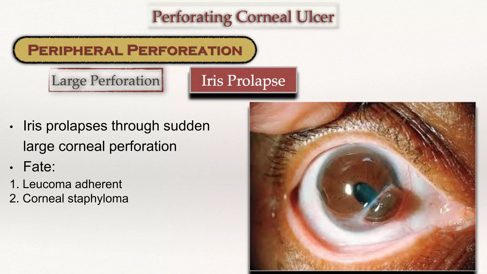 Cornea integrated.pptx