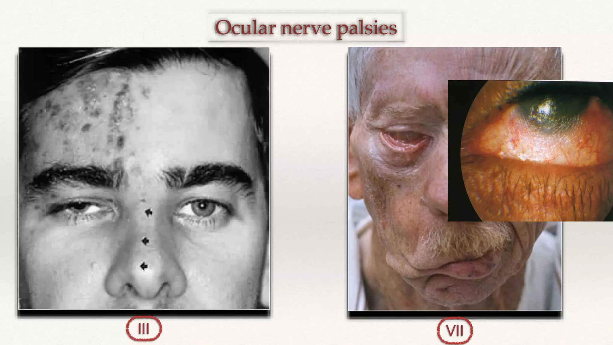 Cornea integrated.pptx | Eye and Vision Conditions | Diseases and ...