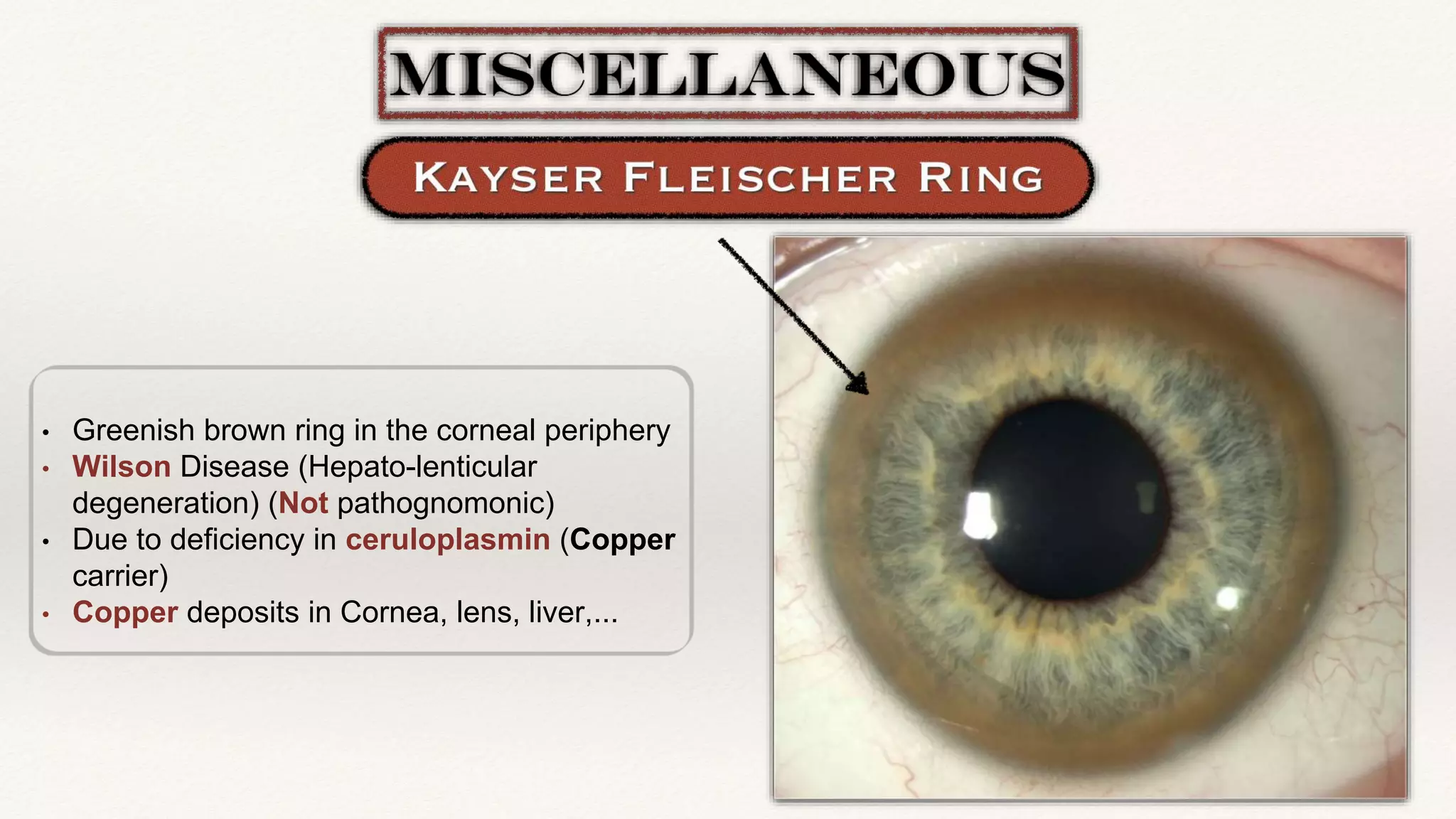 Cornea integrated.pptx