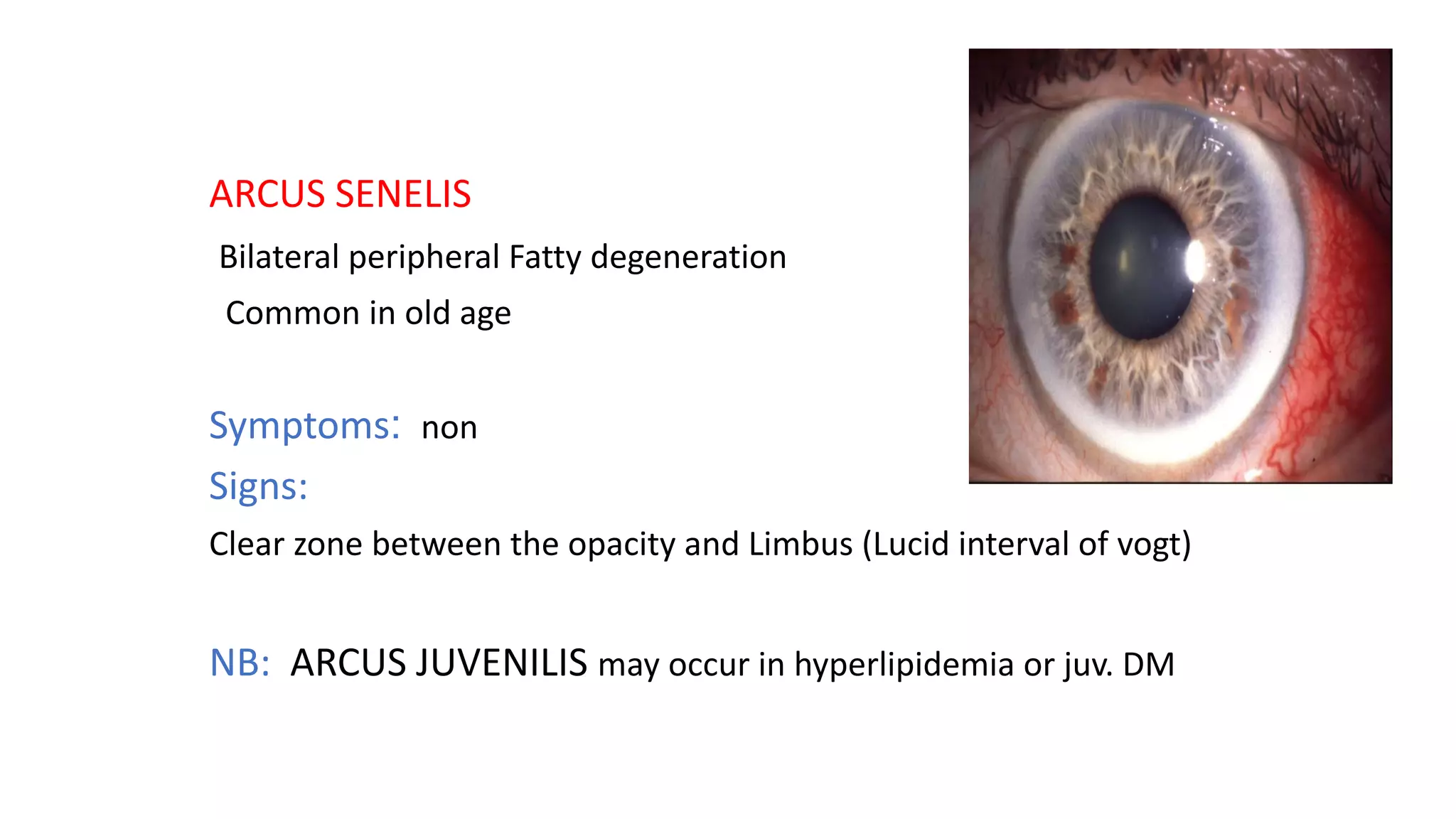 Cornea integrated.pptx