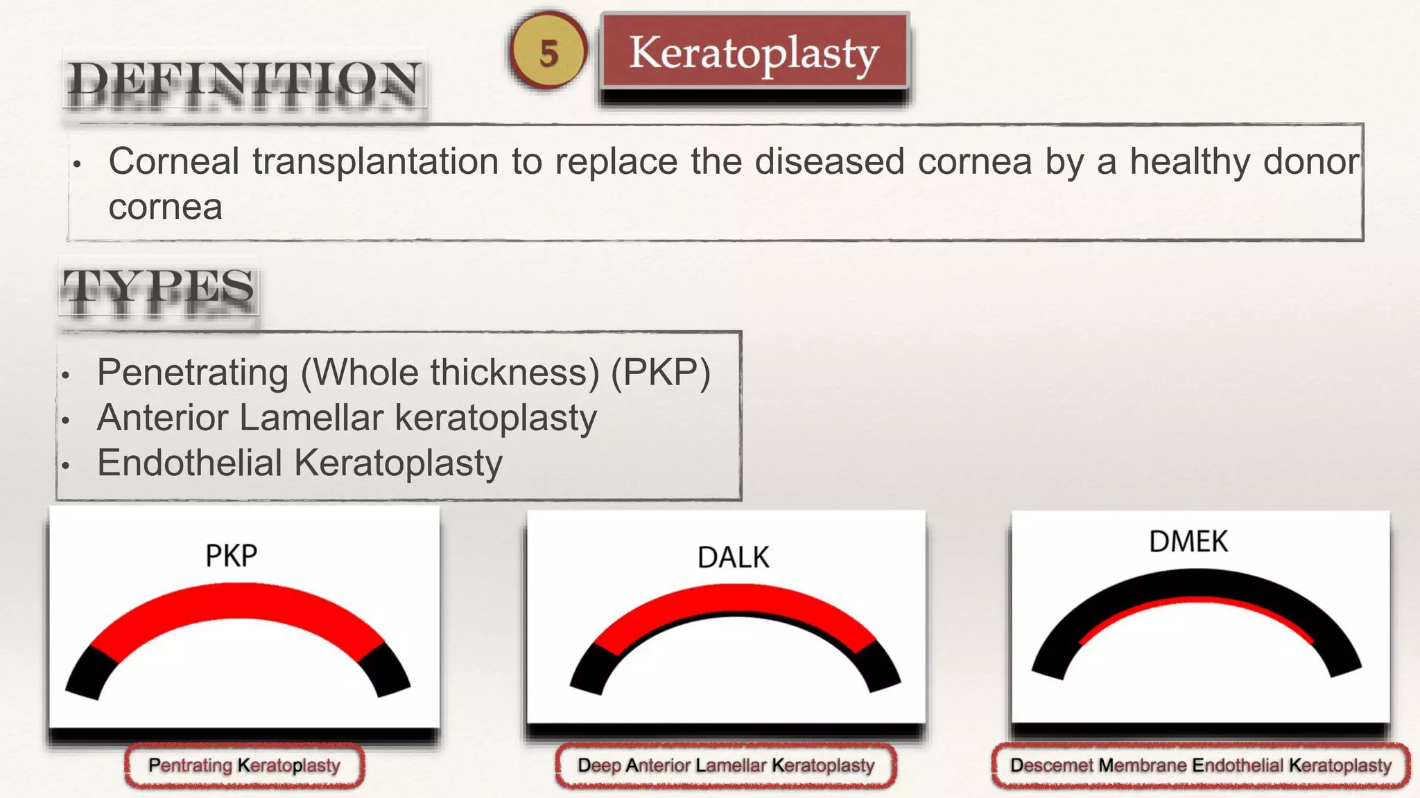 Cornea integrated.pptx