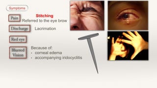 Cornea integrated.pptx