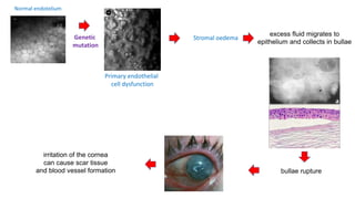 CORNEAL-DYSTROPHIES-Nafiz(2).pptx