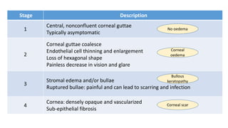 CORNEAL-DYSTROPHIES-Nafiz(2).pptx