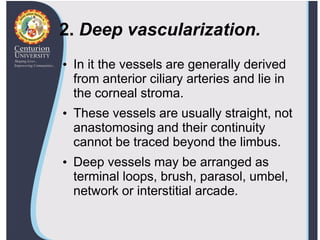 Corneal-vascularisation.pdf cornea disease | PDF