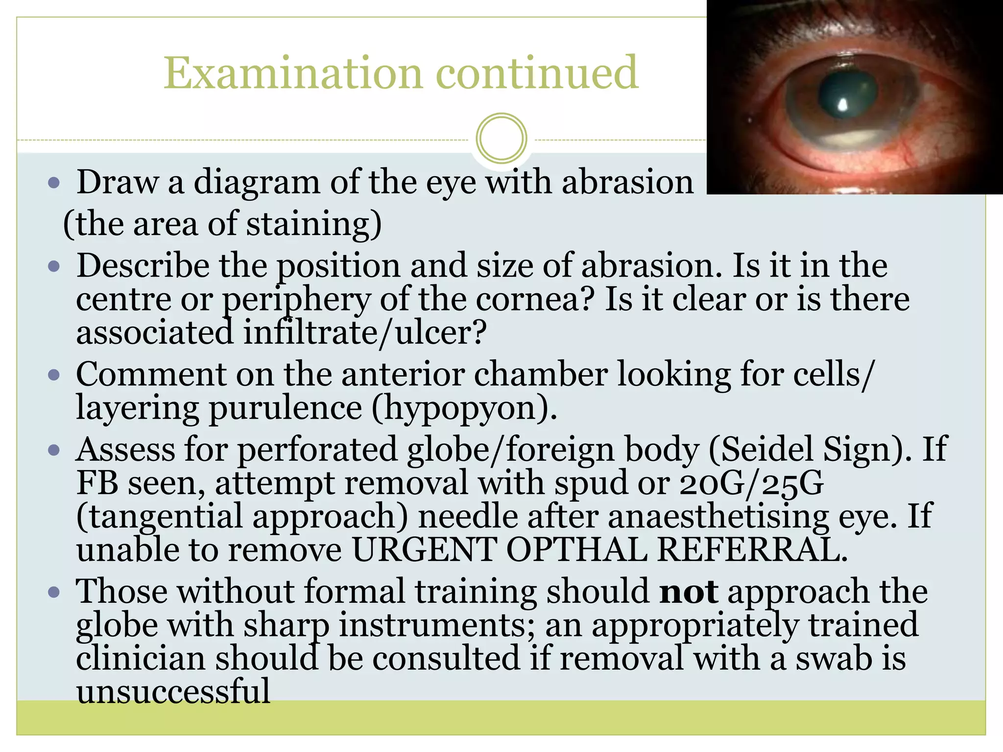 Corneal abrasions and f bs | PPTX