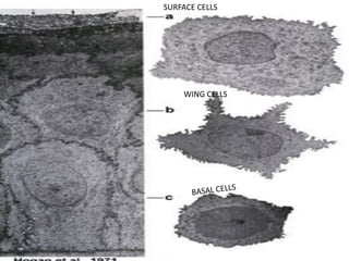 Corneal anatomy ......arya | Eye and Vision Conditions | Diseases and ...