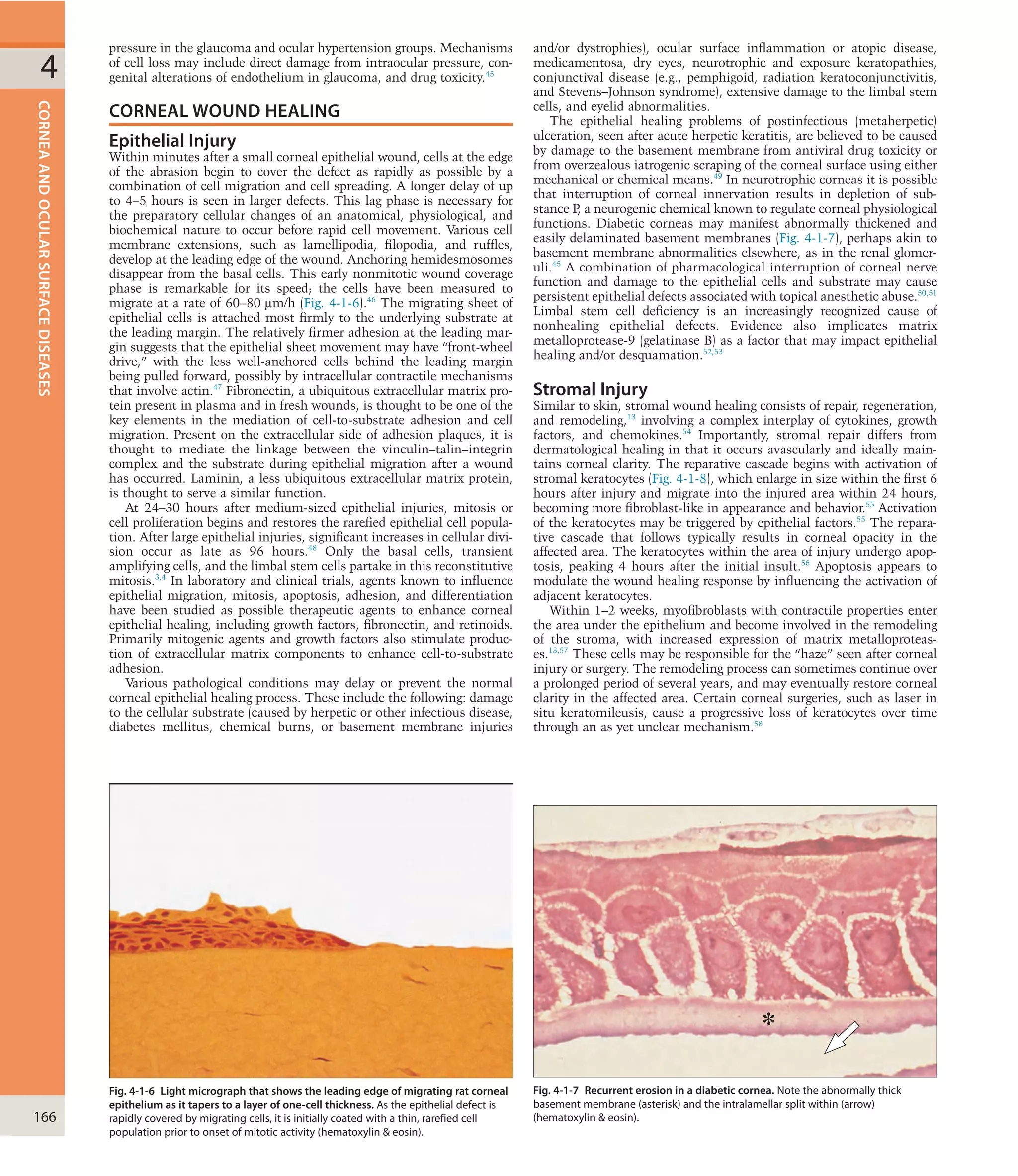 Corneal anatomy physiology and wound healing | PDF