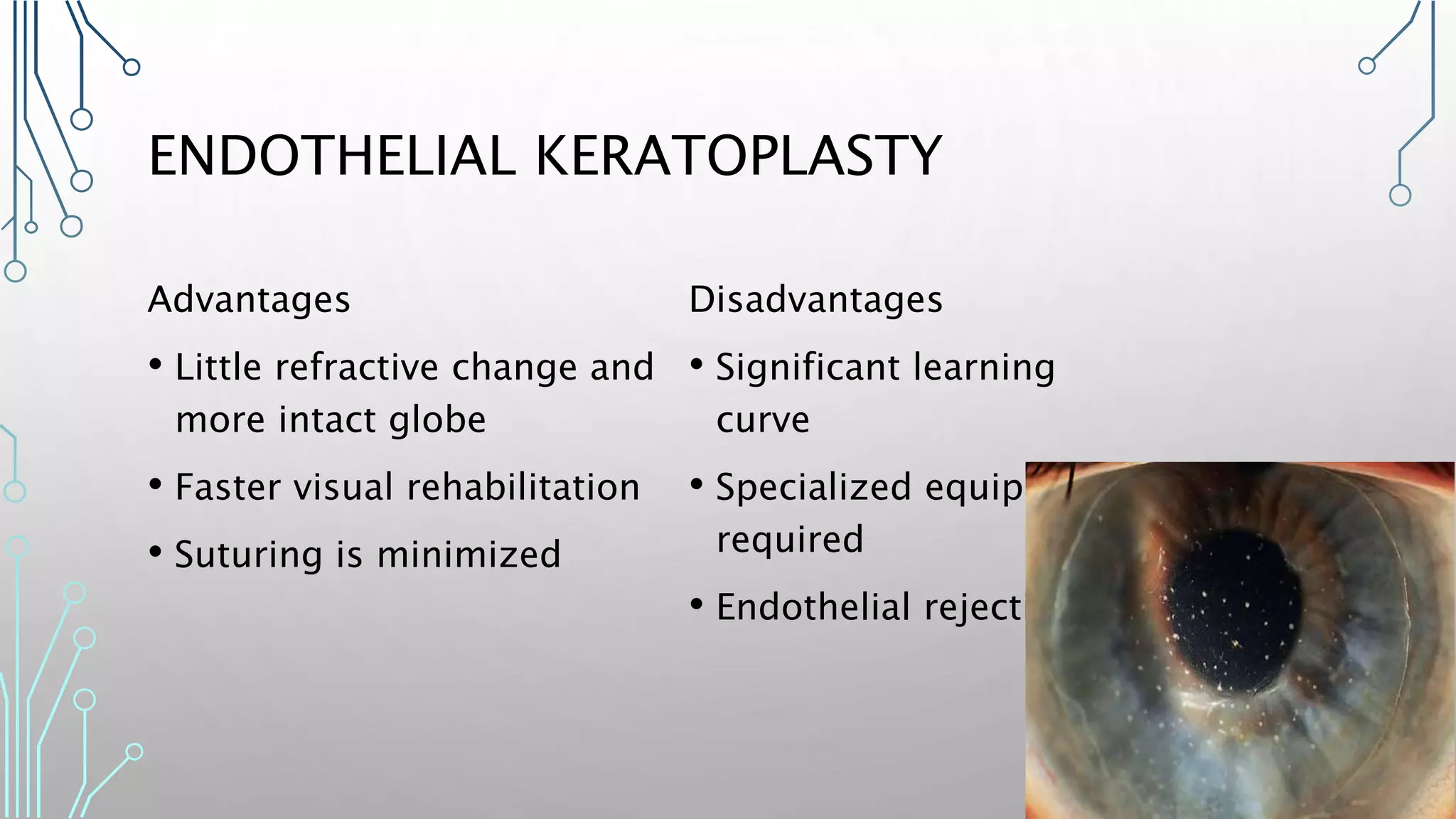 CORNEAL AND REFRACTIVE SURGERY | PPTX