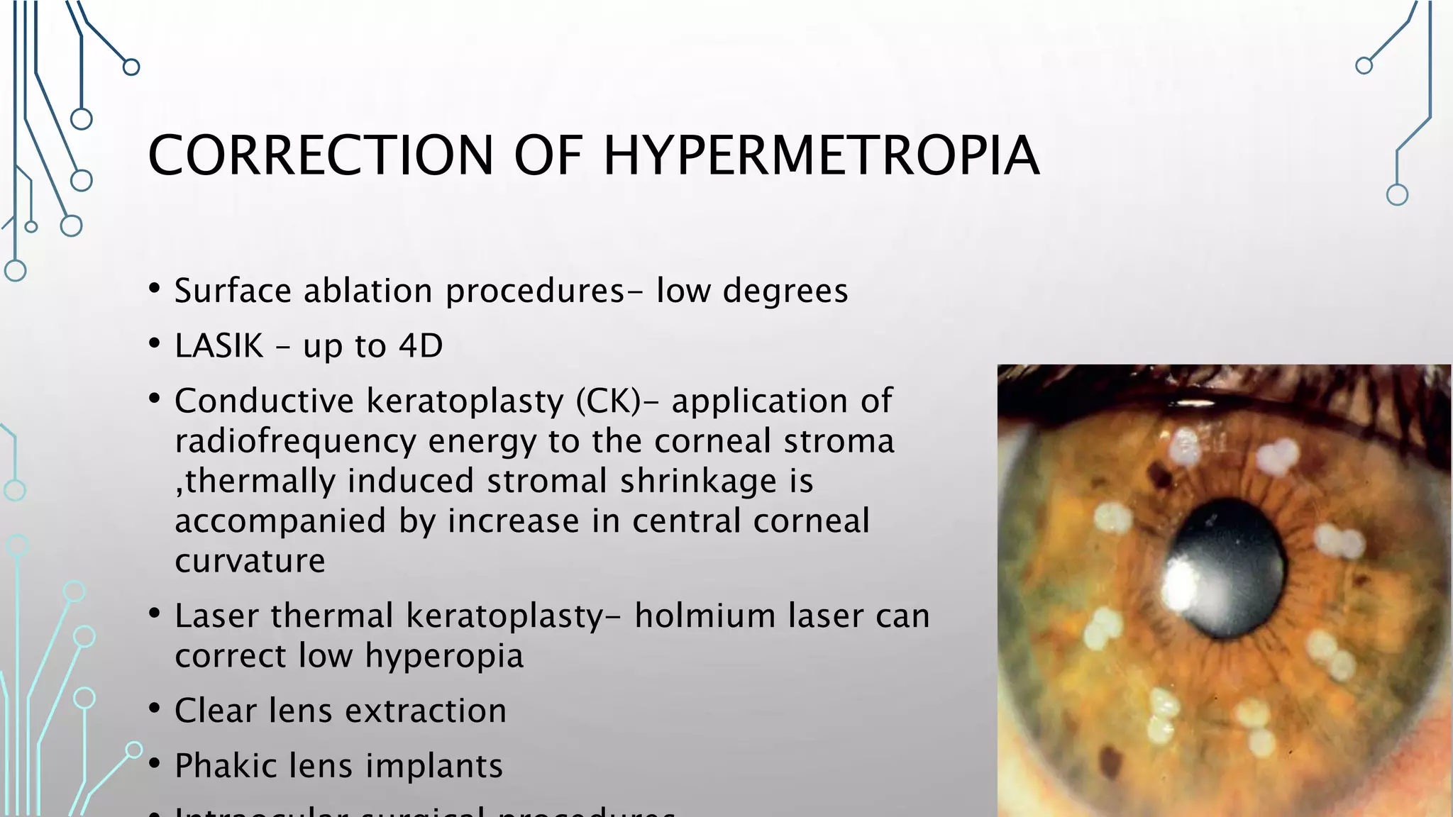 CORNEAL AND REFRACTIVE SURGERY | PPTX