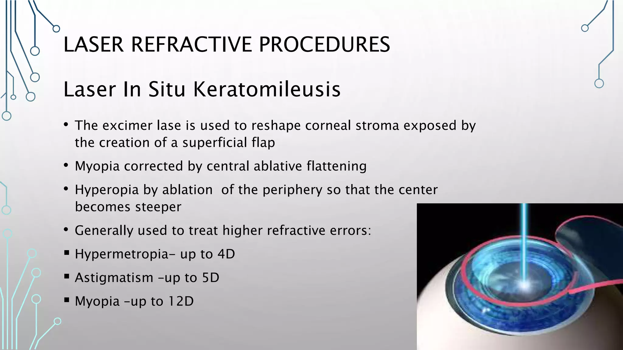 CORNEAL AND REFRACTIVE SURGERY | PPTX