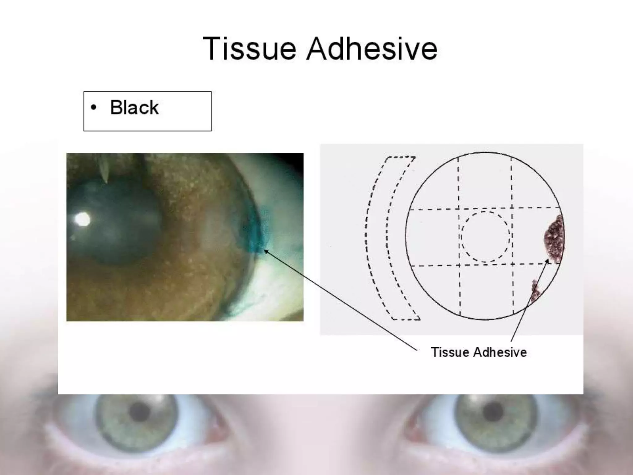 Eye colour coding | PPTX