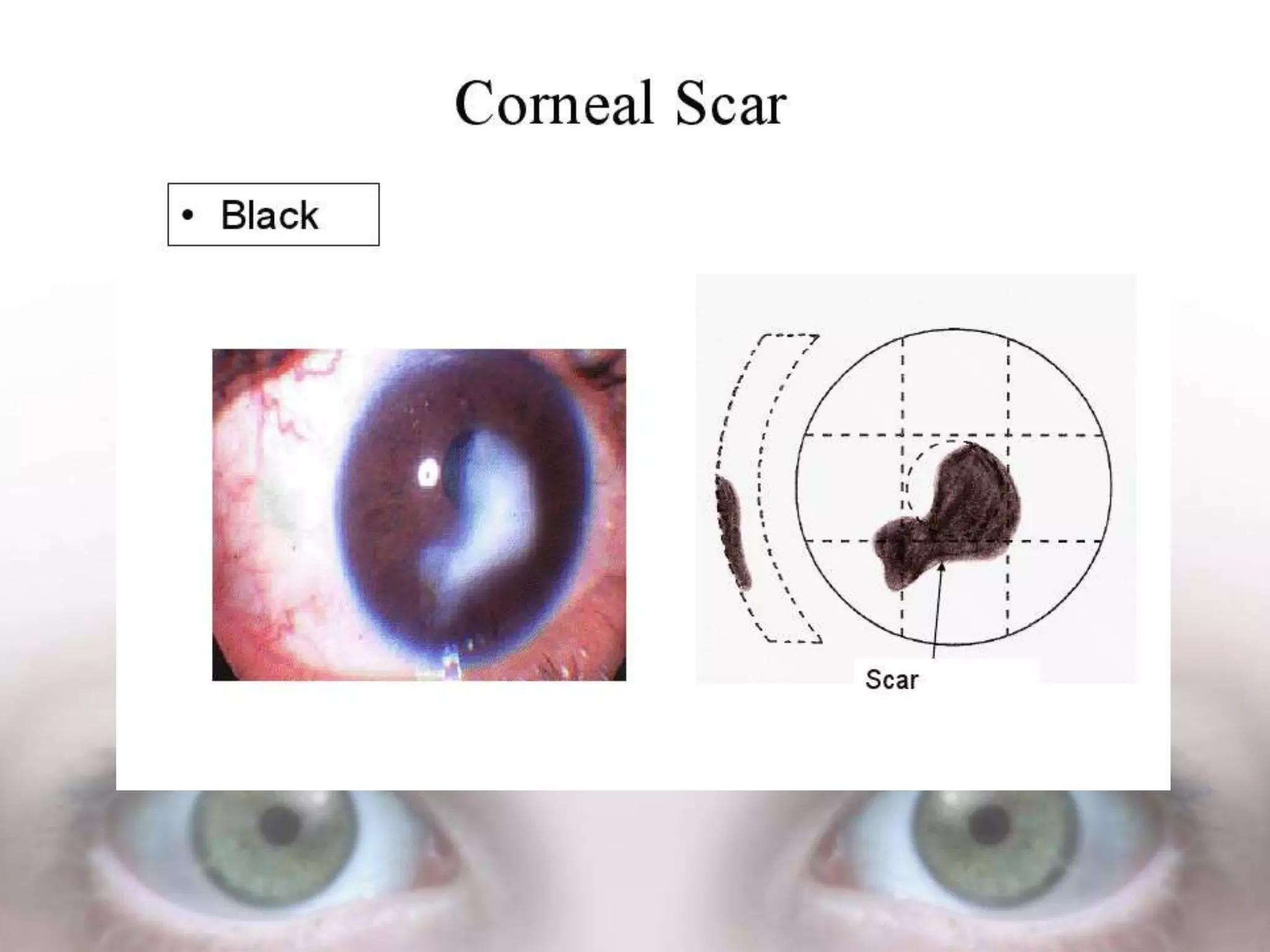 Eye colour coding | PPTX