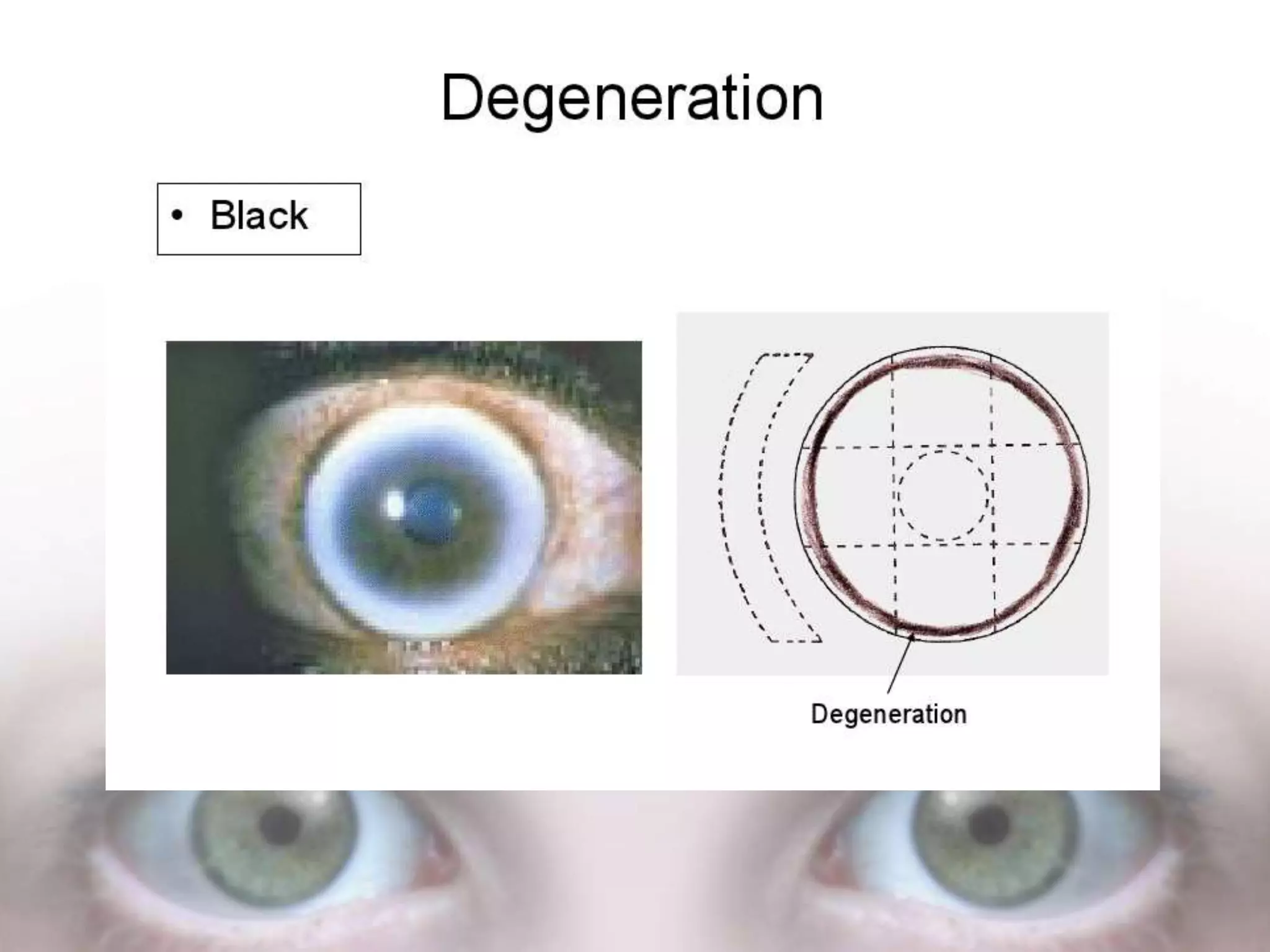 Eye colour coding | PPTX