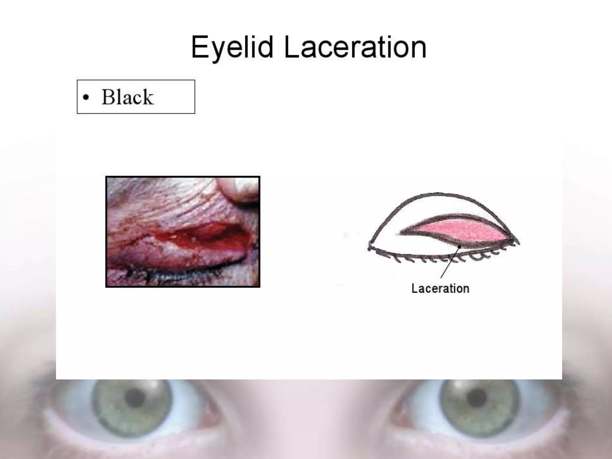 Eye colour coding | PPTX