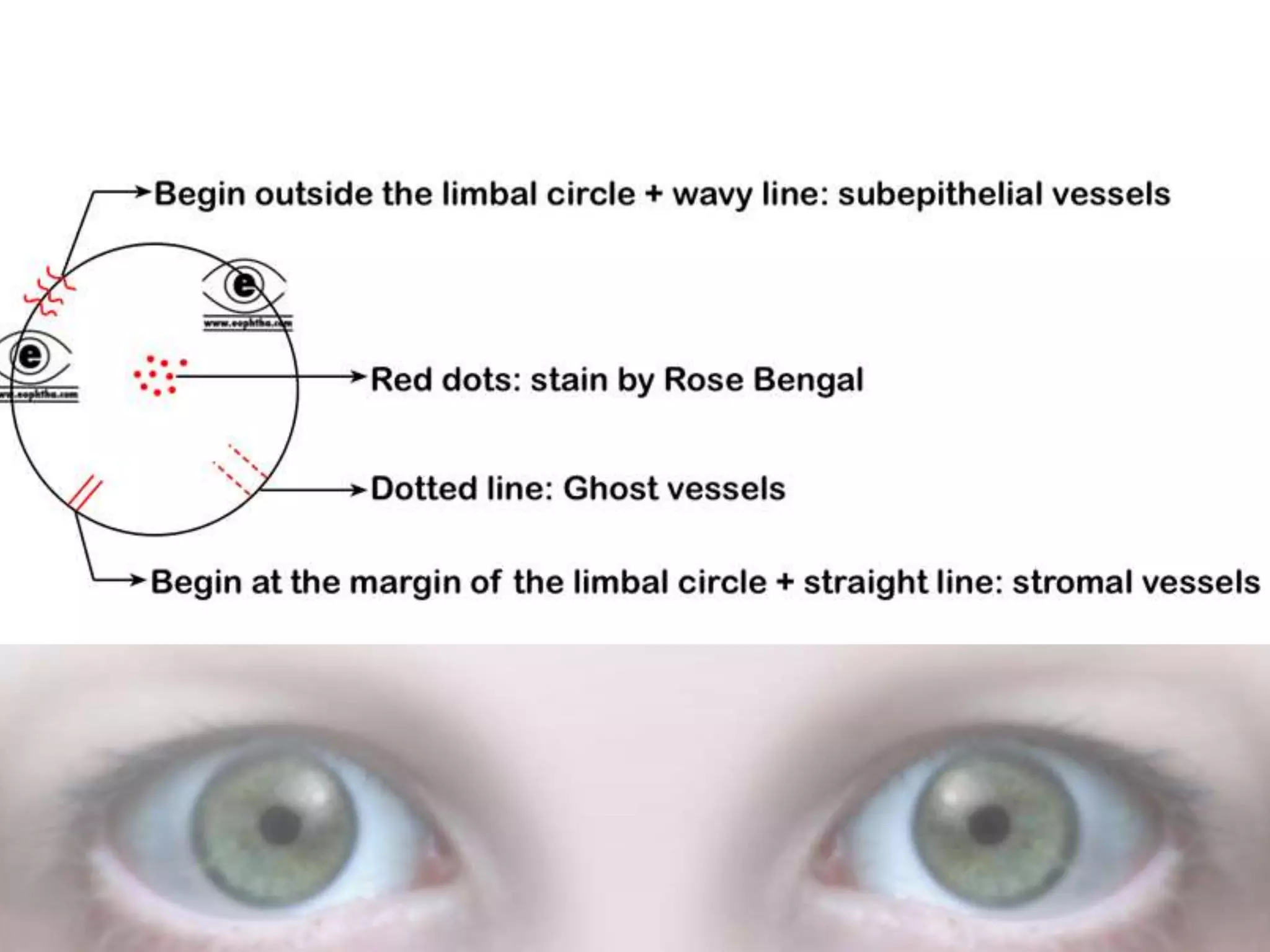 Eye colour coding | PPTX
