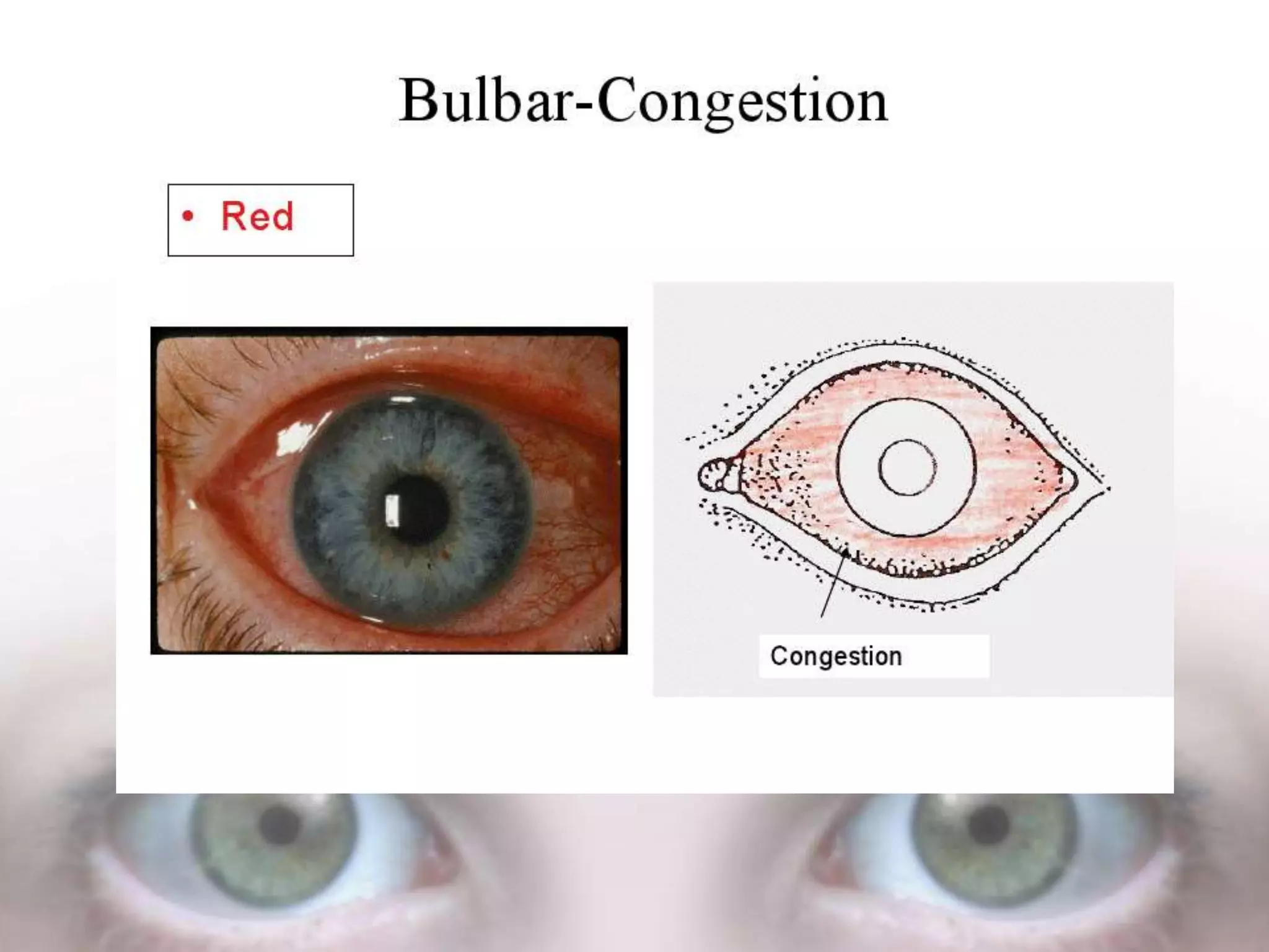 Eye colour coding | PPTX