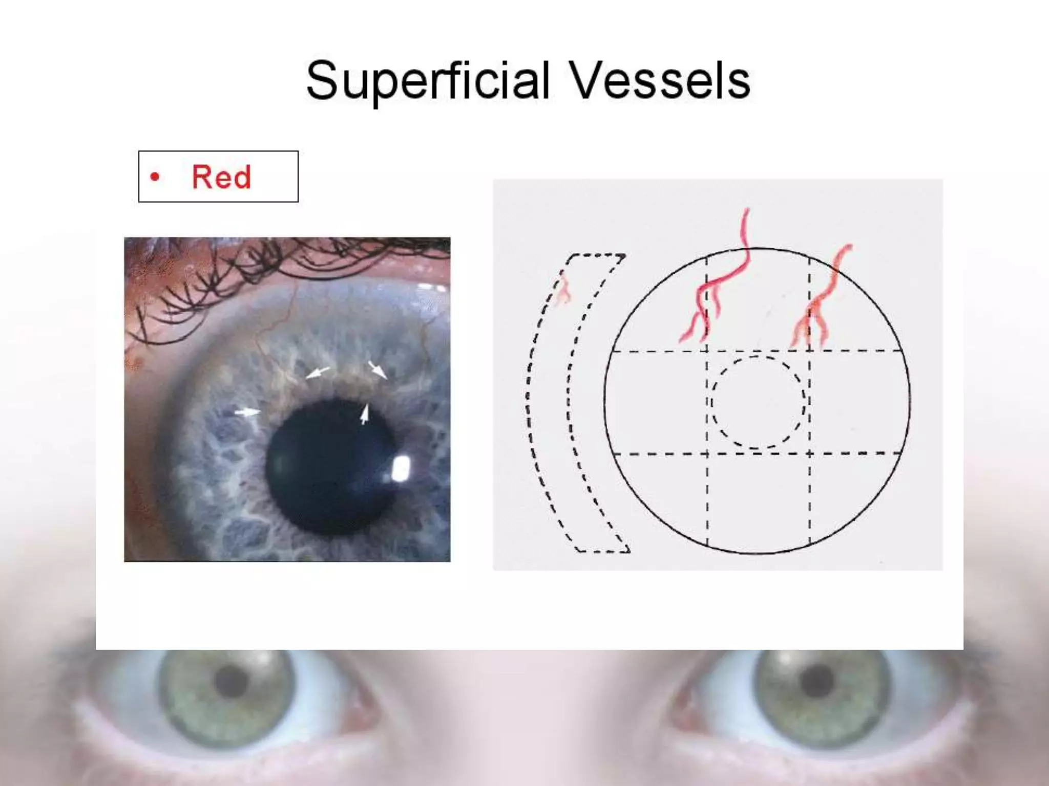 Eye colour coding | PPTX