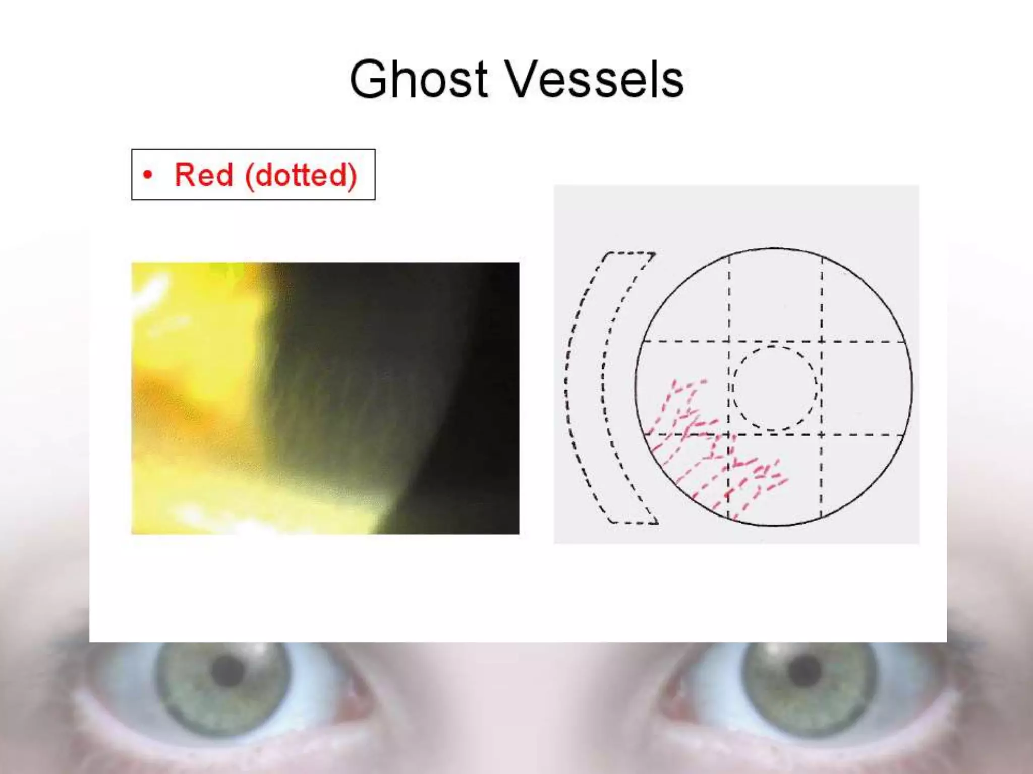 Eye colour coding | PPTX