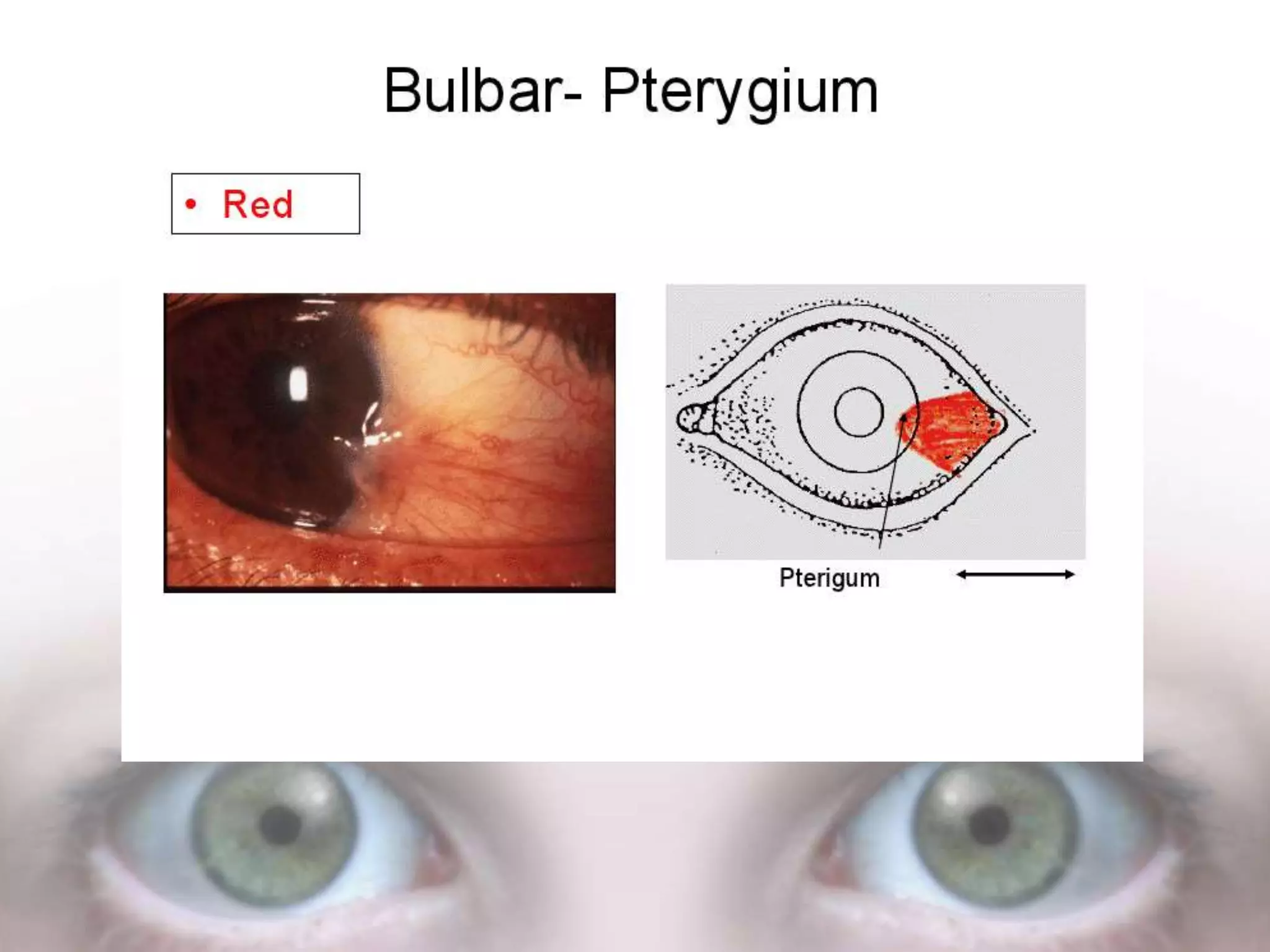 Eye colour coding | PPTX