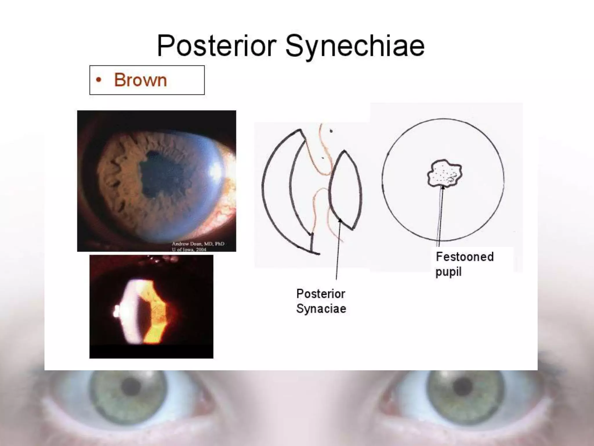 Eye colour coding | PPTX