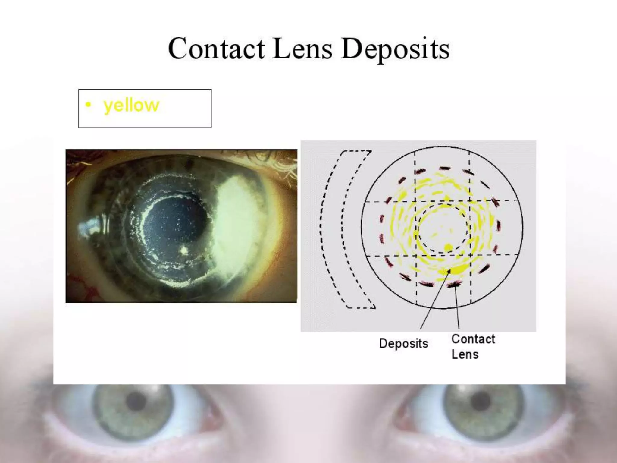 Eye colour coding | PPTX