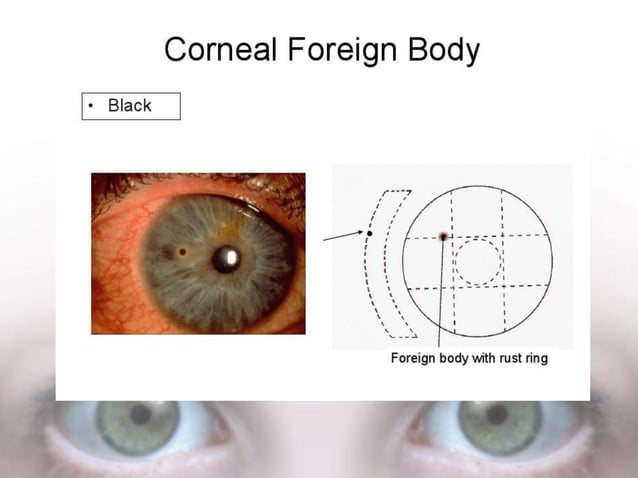 Eye colour coding | PPTX