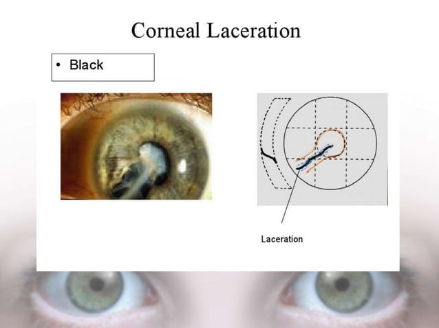 Eye Colour Coding Pptx 4601