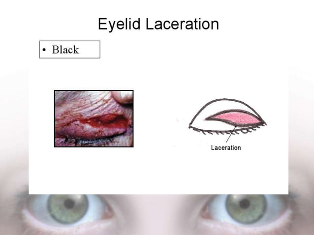 Eye colour coding | PPTX