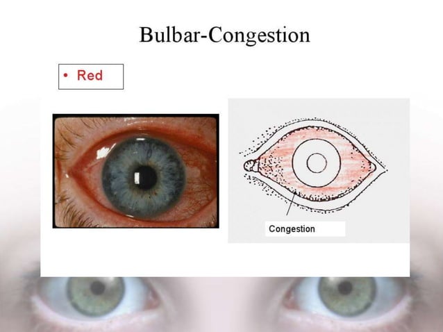 Eye colour coding | PPTX