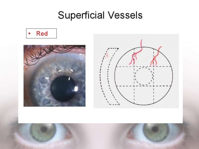 Eye colour coding | PPTX