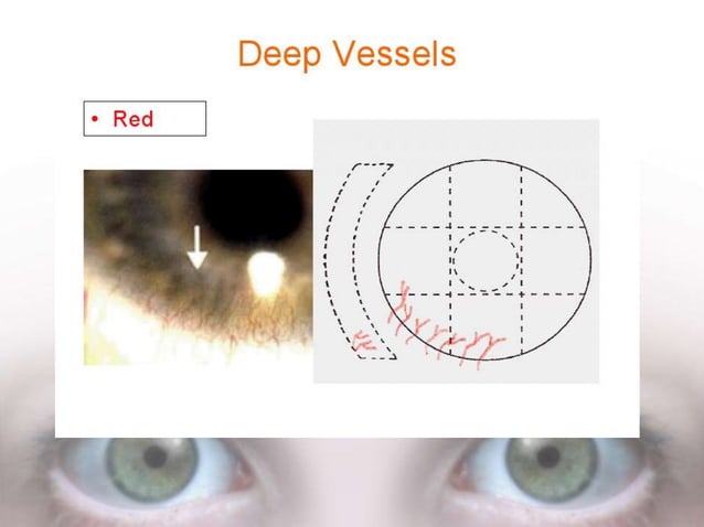 Eye colour coding | PPTX