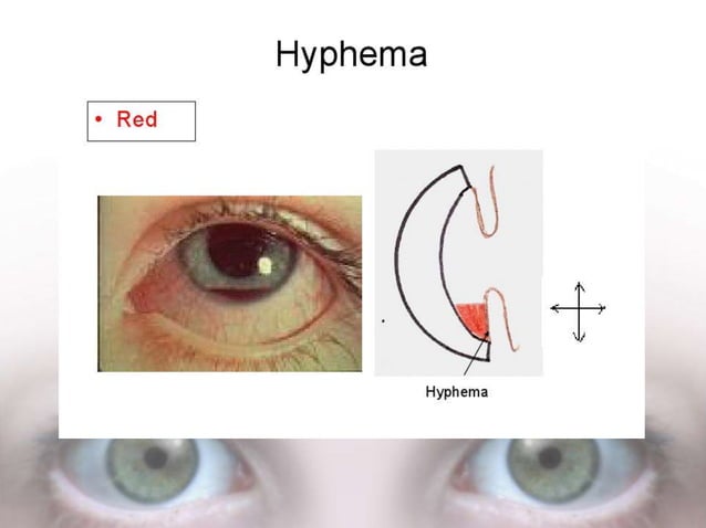 Eye colour coding | PPTX