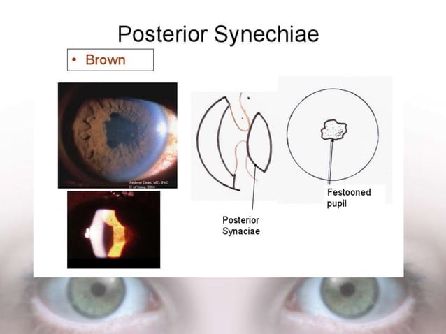 Eye colour coding | PPTX