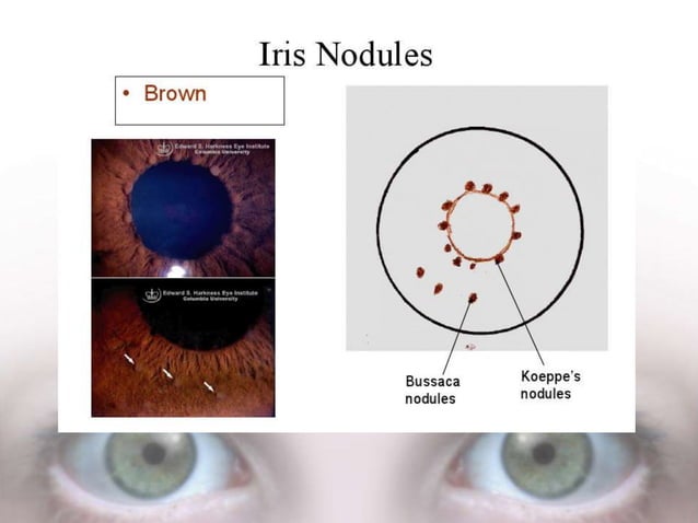 Eye colour coding | PPTX