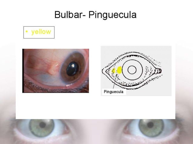 Eye colour coding | PPTX