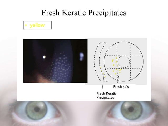 Eye colour coding | PPTX