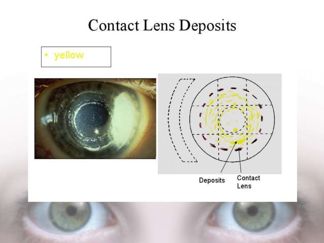 Eye colour coding | PPTX