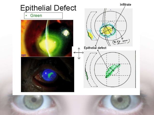 Eye colour coding | PPTX